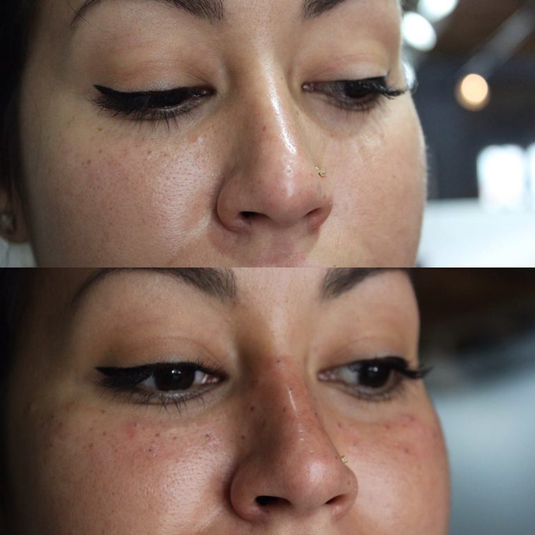 Semi-Permanent Freckle Face Tattoos Are Apparently a Beauty Trend Now