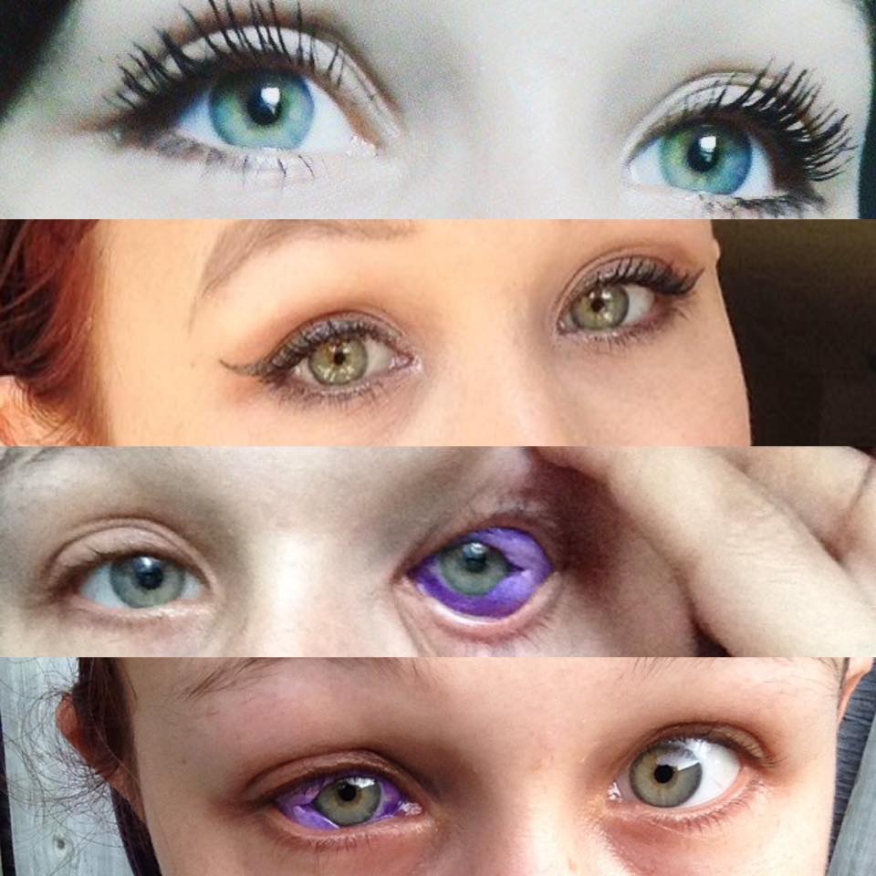 Botched Eyeball Tattoo Leaves Woman Crying Blue Tears