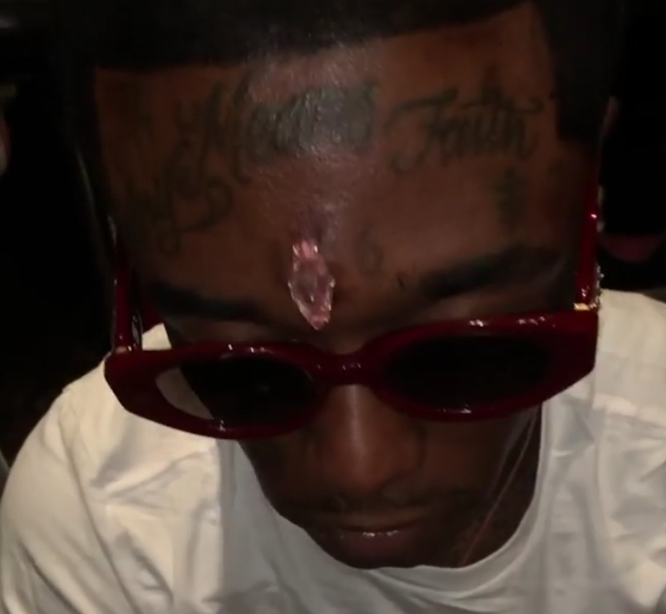 Rapper Allegedly Has Pink Diamond Embedded in His Forehead