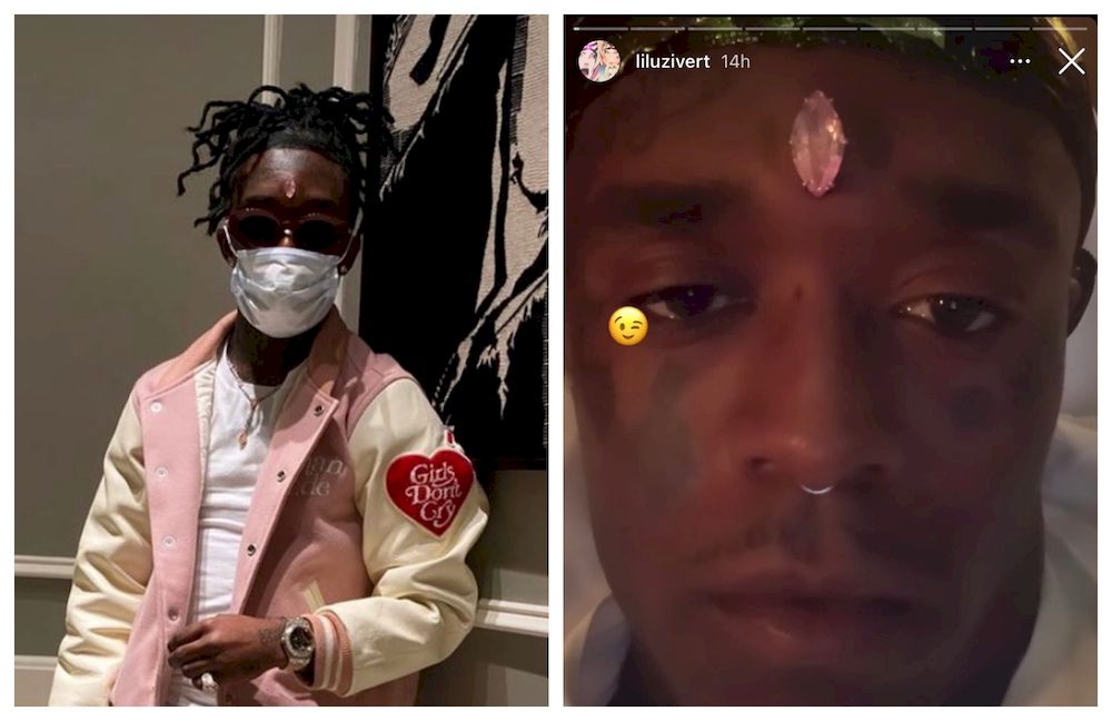 Rapper Allegedly Has Pink Diamond Embedded in His Forehead