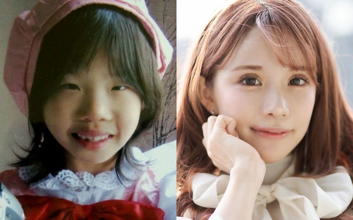 Japanese Influencer Claims $140,000 Worth of Plastic Surgery Completely ...