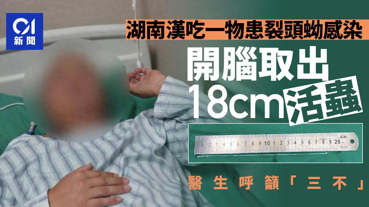 Doctors Remove 18-Cm-Long Living Worm from Man’s Brain