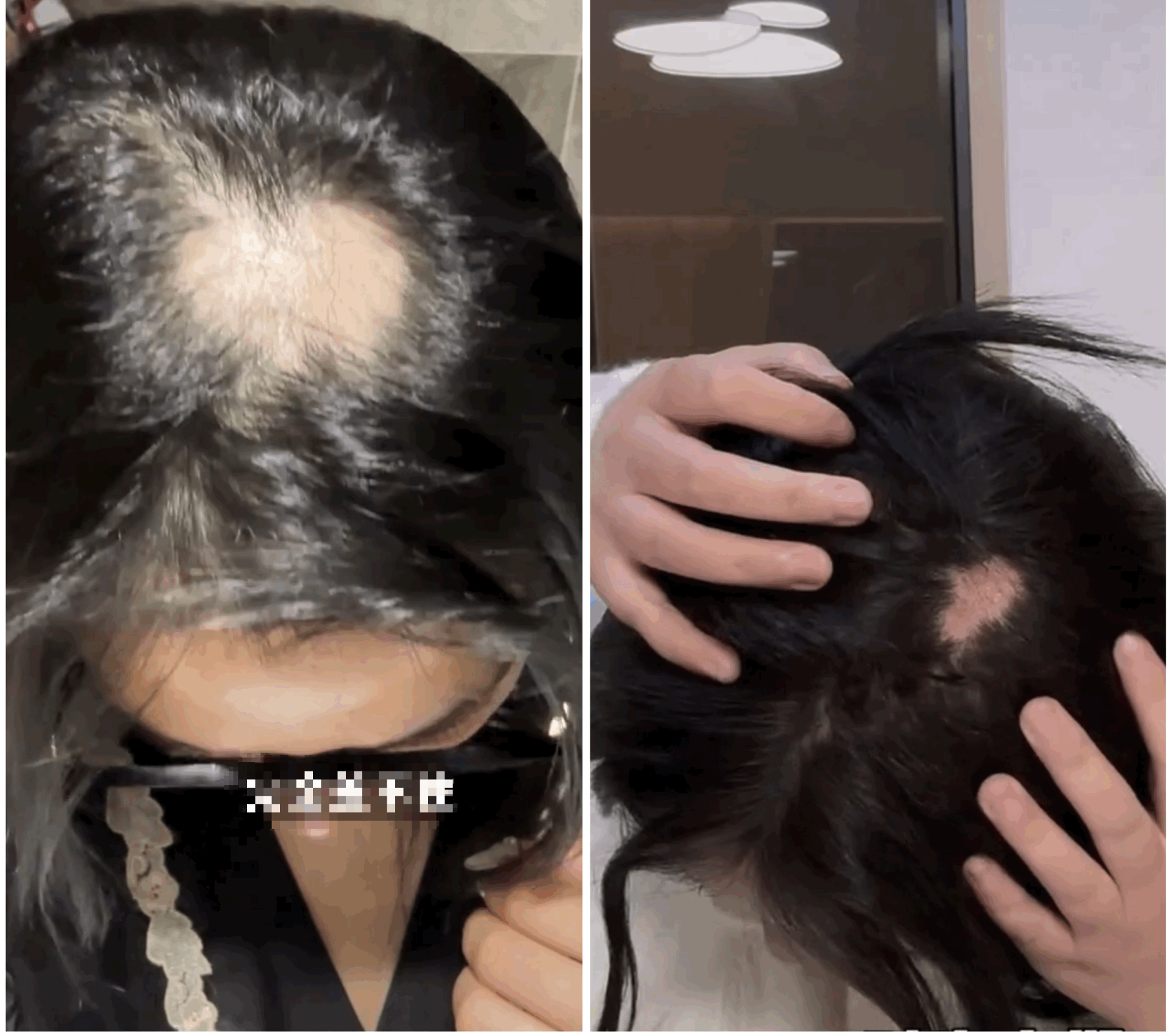 The High Skull – China’s Bizarre Beauty Trend Has People Changing the ...